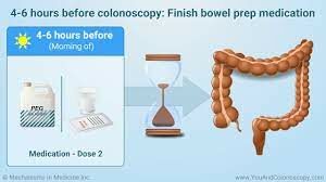 What Is The Easiest Colonoscopy Prep? - JustEasiest